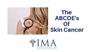 ABCDE's of Skin Cancer - Integrated Medicine Alliance
